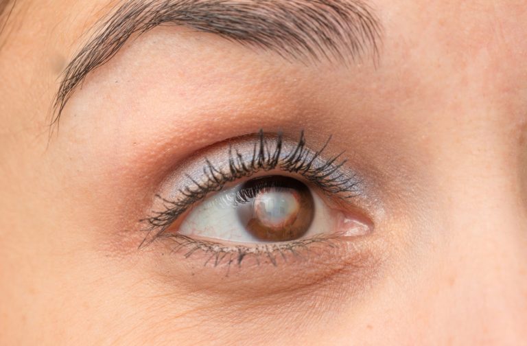 Does Everyone Get Cataracts 